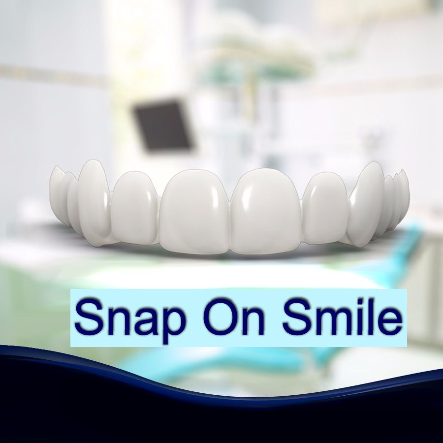 Snap-On Smile | Curitiba | Clínica Odontológica Ortozen
